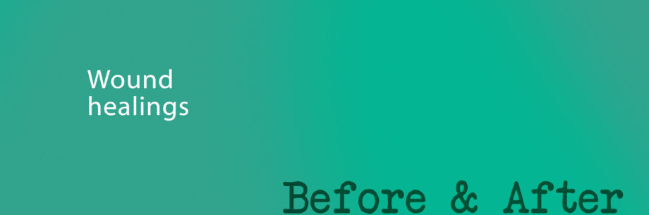 Know the clinical evidence, Before & after with SODERMIX® Cream – LSI ...